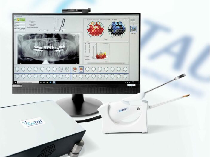 Einsatzgebiete & Anwendungsbeispiele | CaviTAU®