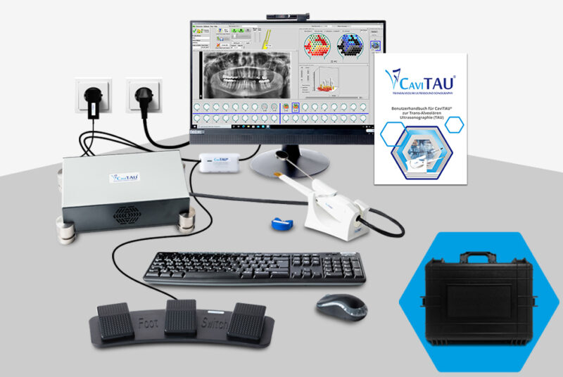 Was ist CaviTAU® | Informationen zum CaviTAU® Gerät